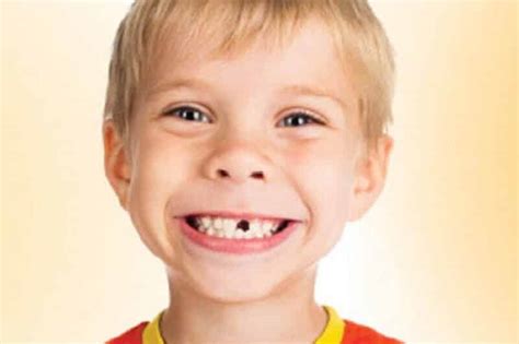 Quelles sont les dents de lait qui tombent À quel âge Kids dental