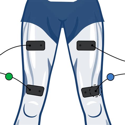 Electrode Placement Compex Australia