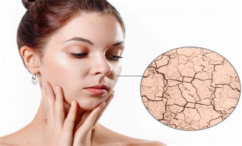 How To Treat Dry Skin On Your Face Blog