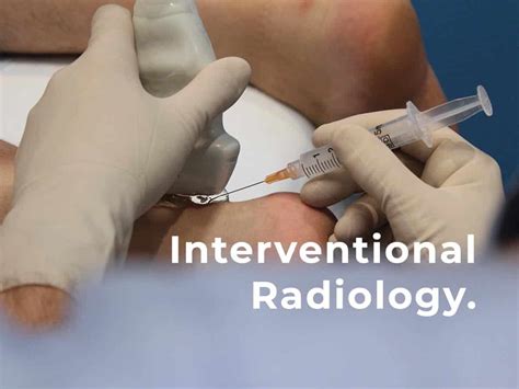 Low Dose CT Scan Patient Fact Sheet Melbourne Radiology