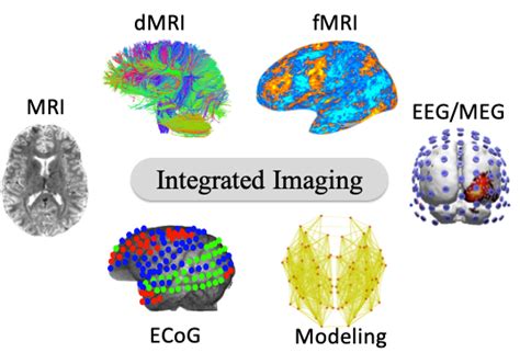 research laboratory of integrated brain imaging