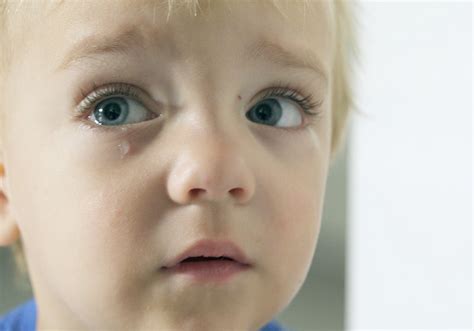 Olhos Inchados 8 Principais Causas E O Que Fazer Para Tratar Descubra