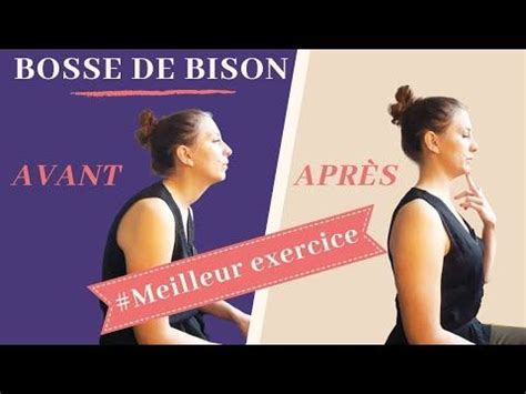 Étirer sa nuque et le haut du dos Comment éviter d avoir la bosse de