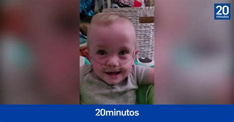 El bebé más prematuro del mundo cumple un año y aprende a gatear