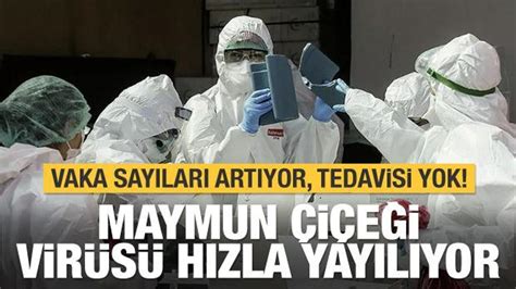 Maymun Çiçeği virüsü nedir nasıl bulaşır Belirtileri ve korunma