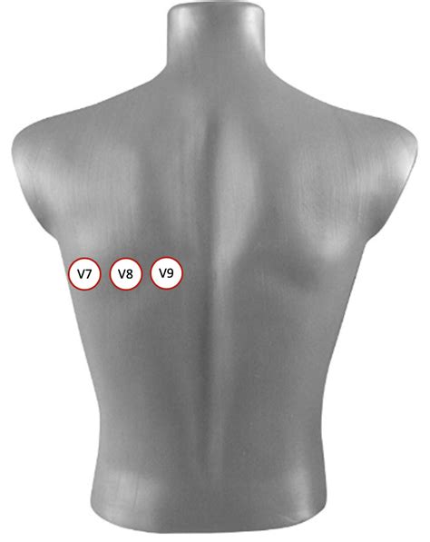 Diagnostics Alternative Ekg Leads Taming The Sru