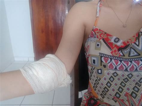 ZDKNEWS Mulher é esfaqueada tentando separar briga entre casal