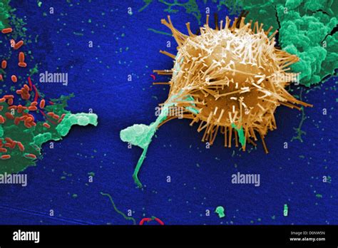This Digitally Colorized Scanning Electron Micrograph SEM Untreated