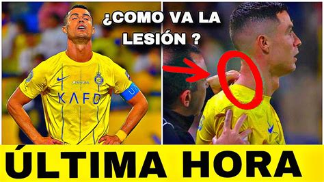 ÚLTIMA HORA SOBRE LA LESION DE CRISTIANO RONALDO HOY CON AL NASSR VS