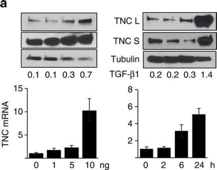 Tenascin C Antibody 4C8MS BSA Free NB110 68136 Novus Biologicals