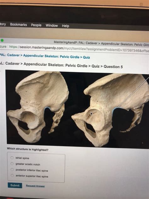 Solved Al Cadaver Appendicular Skeleton Pelvic Girdle Chegg