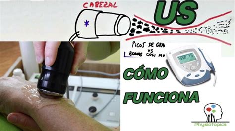 Todo sobre el ultrasonido terapéutico aplicaciones indicaciones y