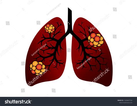 Human Lungs Anatomy Structure Isolated On Stock Vector Royalty Free