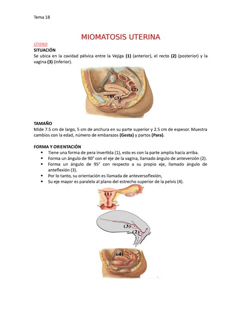 Miomatosis uterina MIOMATOSIS UTERINA ÚTERO SITUACIÓN Se ubica en la
