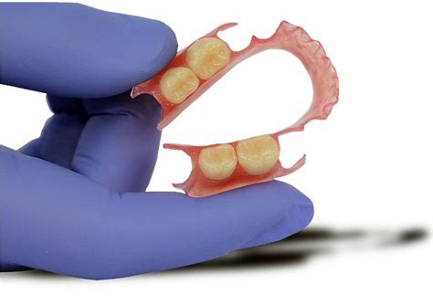 Quais são as vantagens de uma prótese flexível OdontoVida