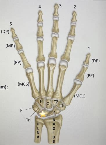 Label The Hand And Wrist Flashcards Quizlet