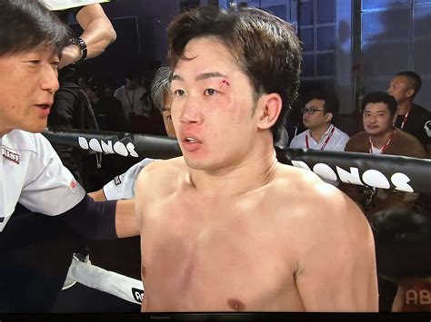 速報朝倉未来YAMANにボコボコにされ1回KO負けwwwwwwwwwww ヤバイニュース
