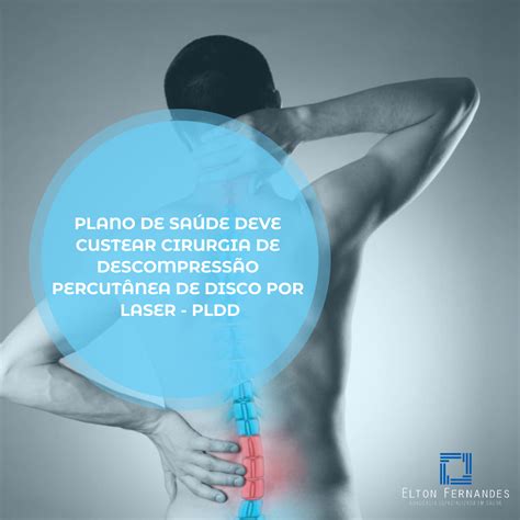Todos os planos de saúde devem custear a Cirurgia de Descompressão