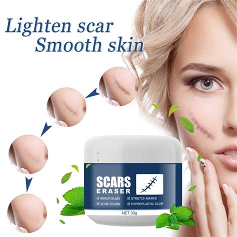 Bluethy 30g Scar Remove Cream Not Irritating Repair Damage Synthetic