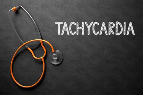 Understanding Tachycardia Causes Symptoms And Treatment Longmore