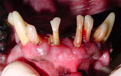 Enlarged Human Canine Teeth