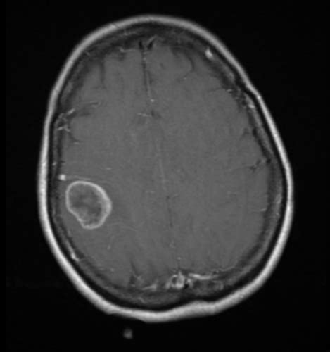 Mri Image Test Flashcards Quizlet