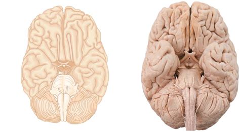 Ventral Inferior Aspect Of The Human Brain Diagram Quizlet