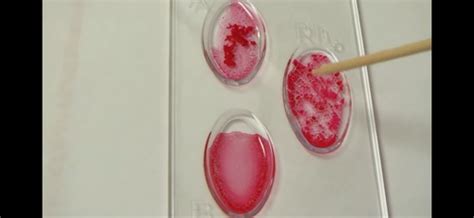 Blood Typing Flashcards Quizlet