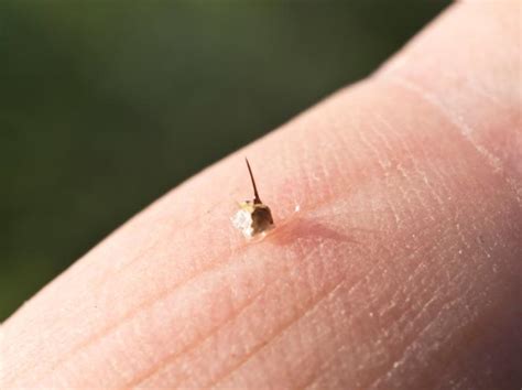 Bee Sting Allergy Symptoms And Other Risk Factors Healthy Lifestyle