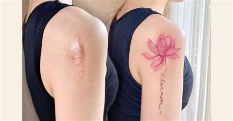 Ideas De Tatuajes Para Cicatrices