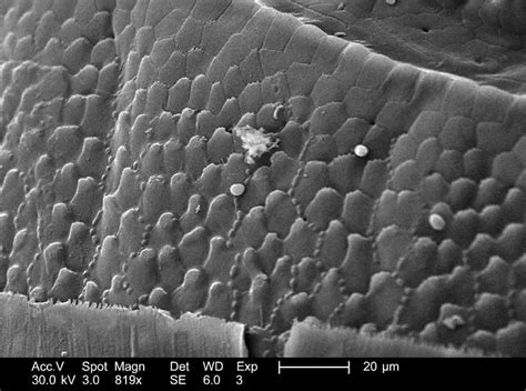 Free Picture Magnified 819x Scanning Electron Micrograph Many