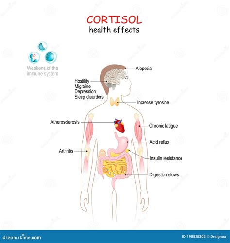 Efectos Sobre La Salud De Cortisol Cuerpo Humano Con órganos Internos