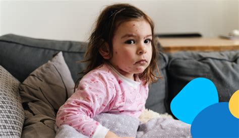 Morbillo Cause Prevenzione E Cura Doctolib