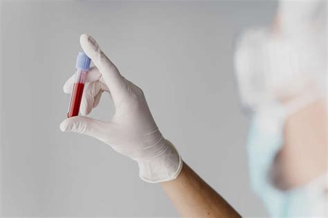 Tipo Sangu Neo E Fator Rh Por Que Saber O Seu Laborat Rio Behring