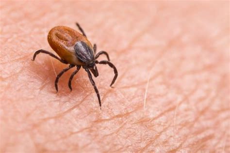 Maladie de Lyme chronique persistante définition cause symptômes