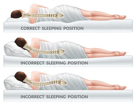 Sleeping Positions For Back And Neck Pain Edison Spine Center
