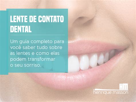 Lente de Contato Dental Um guia completo para você saber tudo sobre
