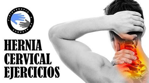 Hernia Discal Cervical O Hernia De Disco Cervical Tratamiento Y