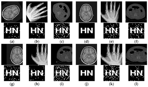 electronics free full text robust zero watermarking algorithm for medical images based on