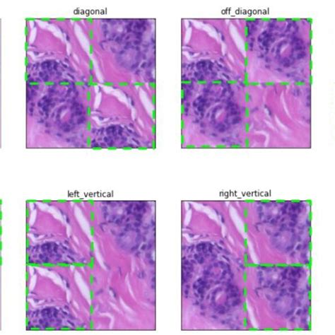 region duplication pretext task for self supervised learning and download scientific diagram