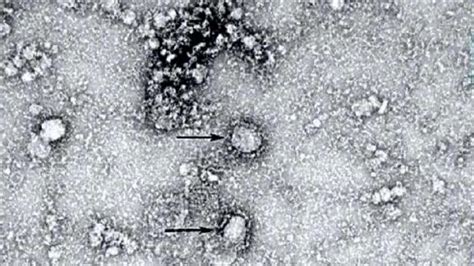 Coronavirus l incubazione è di 24 giorni