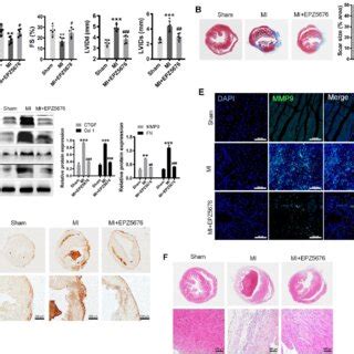 Inhibiting Dot1L Prevents Cardiac Fibrosis And Improves Cardiac