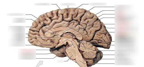 Sagittal Section Of Brain Diagram Quizlet