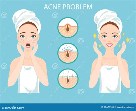 L ado Bouleversé Avec Le Problème De Peau Facial Femelle Doit S