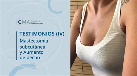 TESTIMONIOS Clínicas Mato Ansorena IV Mastectomía subcutánea y
