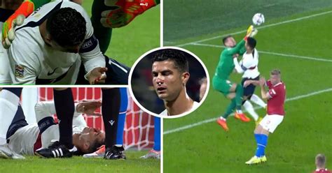 Lo dejó sangrando El terrible golpe que le dieron a Cristiano Ronaldo
