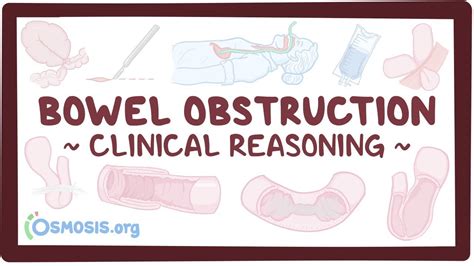Bowel Obstruction Clinical Video Causes Meaning Osmosis