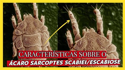 CARACTERÍSTICAS DO ÁCARO SARCOPTES SCABIEI QUE É O CAUSADOR DA