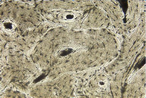 Compact Bone Histology Diagram Quizlet