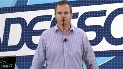 Jornalista aparece rosto machucado em programa ao vivo após ser